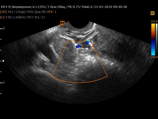 Ultrasound frame Object Detection Dataset by project1710