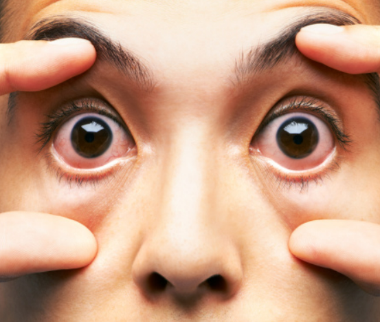 open eyes close eyes detection Object Detection Dataset by university ...