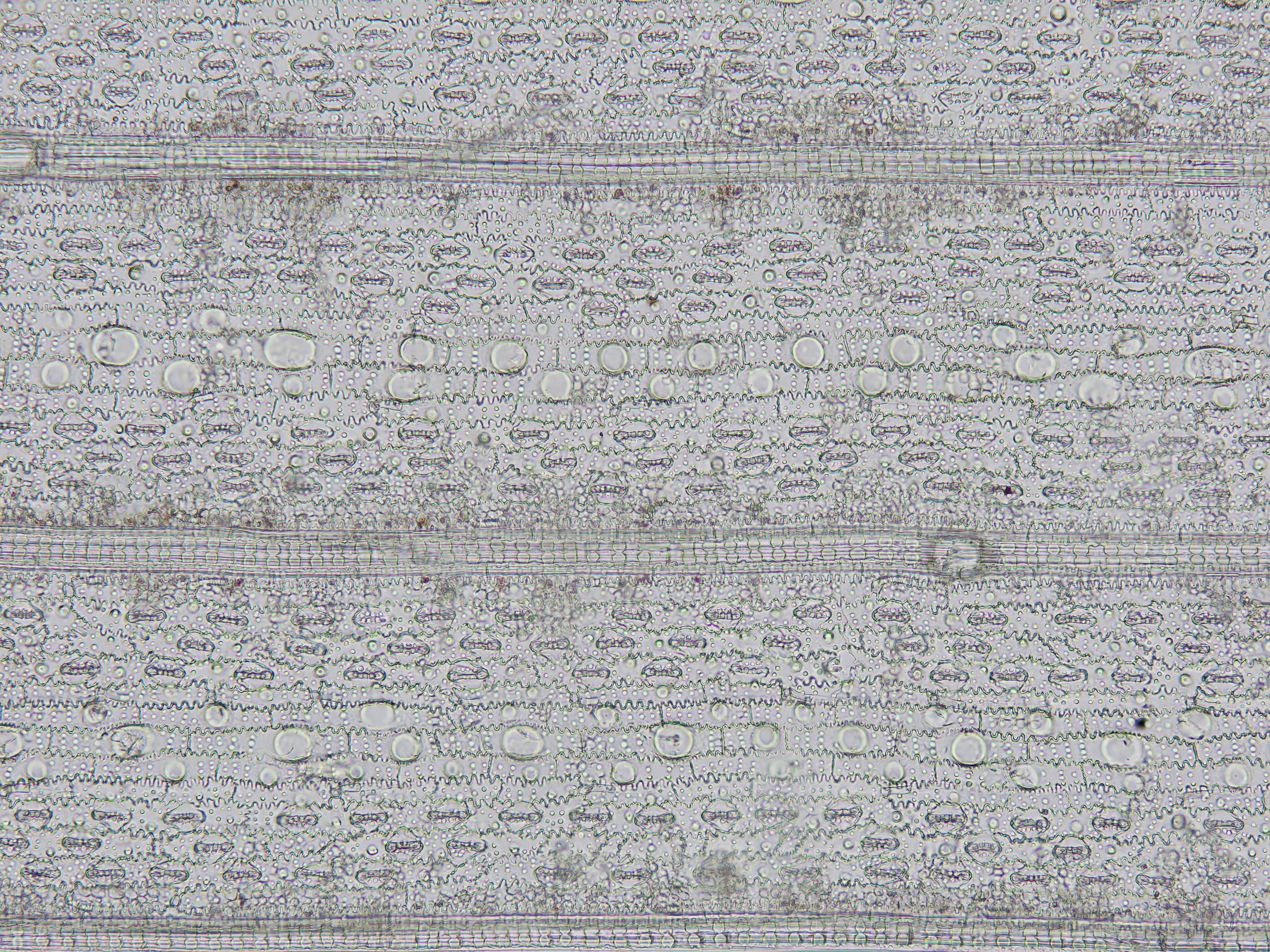 Stomata Object Detection Model By Stomata
