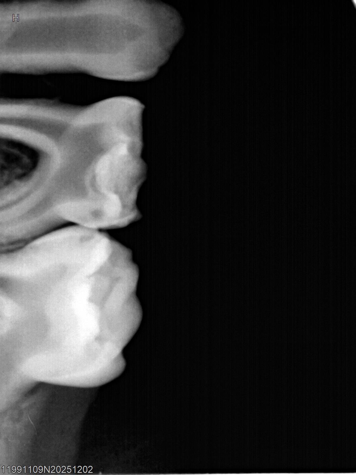 deepcariesscan Object Detection Dataset by ProjectsByQaziMuhammadAflah