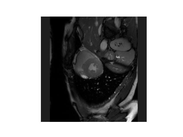 ACDC Object Detection Dataset and Pre-Trained Model by LPR