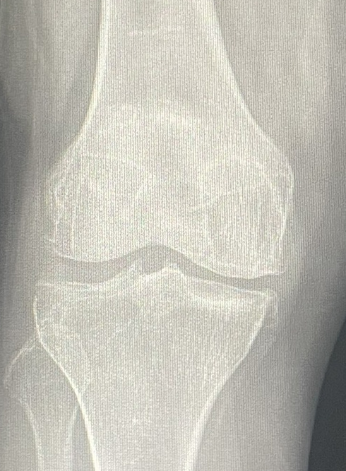 Seg2 Instance Segmentation Dataset and Pre-Trained Model by GSOFT