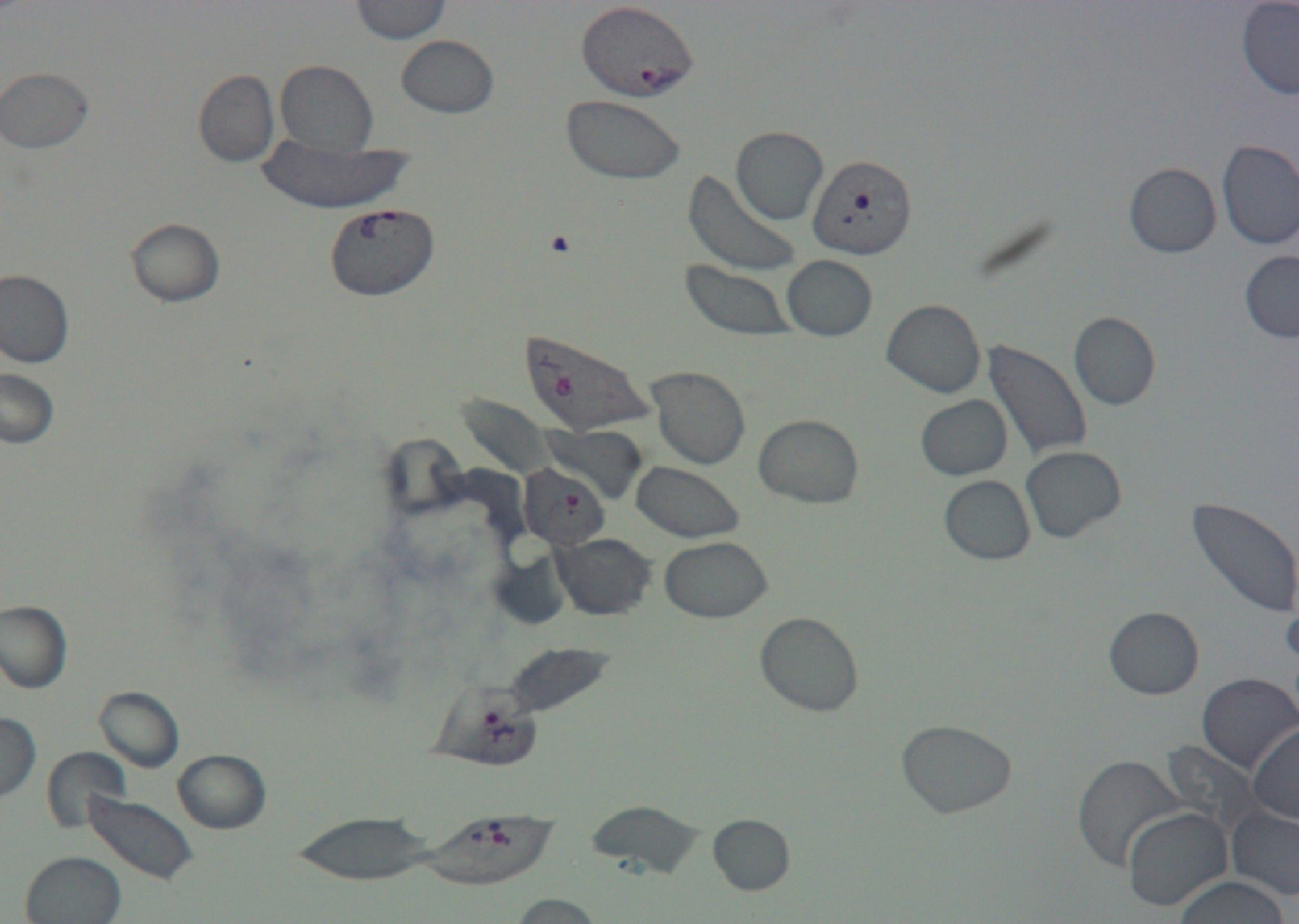 How to Use the Malaria cell detection Object Detection API