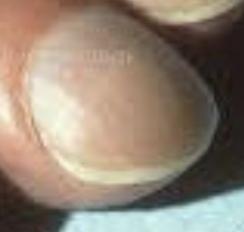 White Nail Classifier Classification Dataset by MyWorkspace