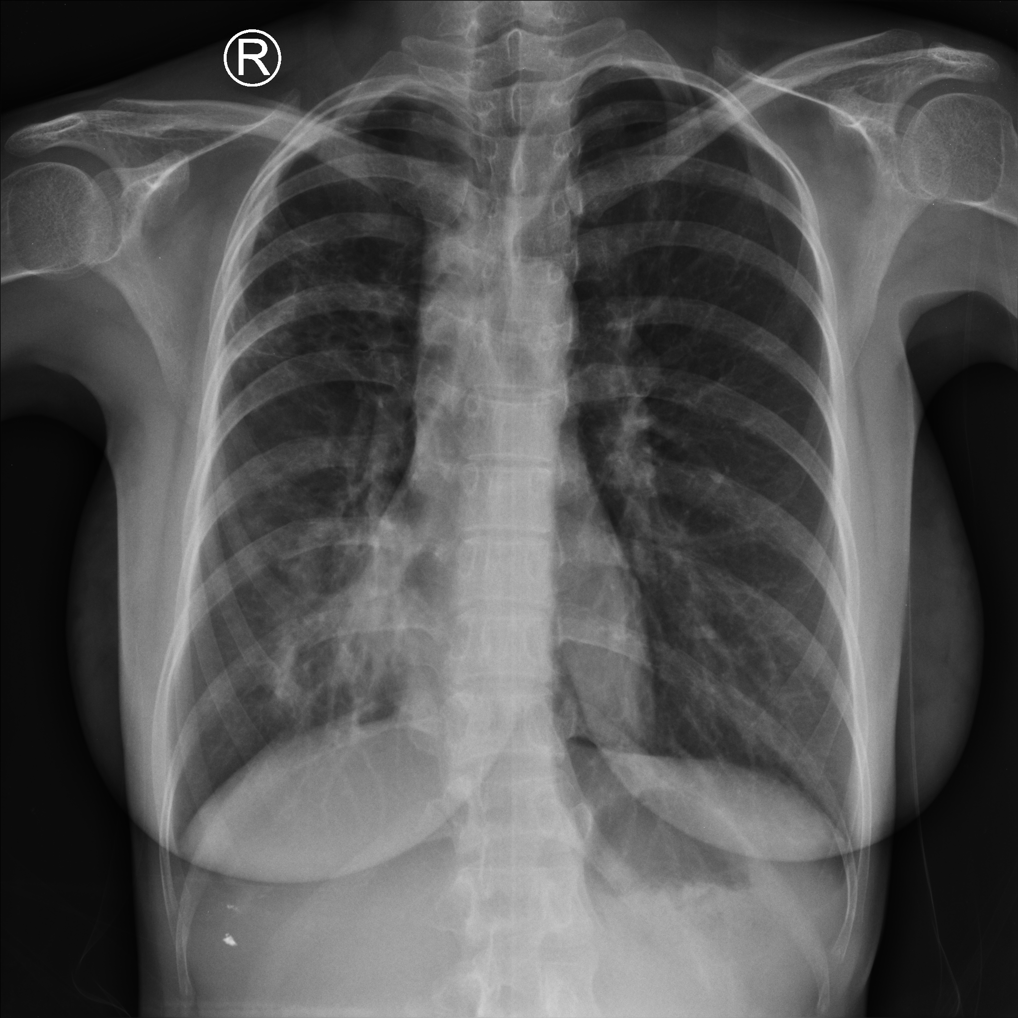 Classify Project Classification Dataset by project