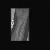 bone Object Detection Dataset by uas citra