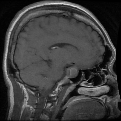 MRI_Brain_Rumor Object Detection Dataset by projects