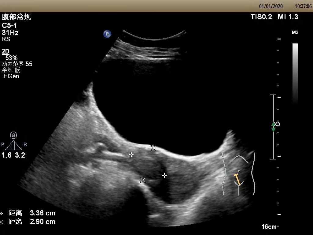UF segmentation Instance Segmentation Dataset and Pre-Trained Model by Makerere University
