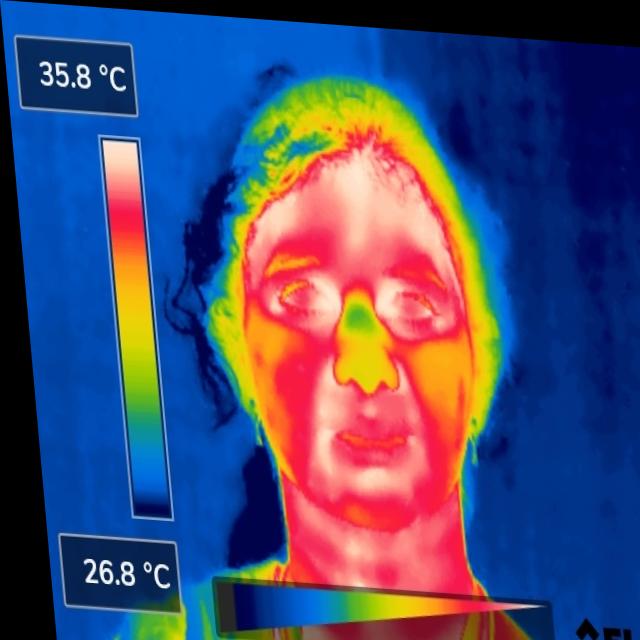 Augm Object Detection Dataset By Vit Chennai