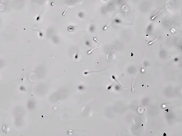 Sperm-Detection-Kim Object Detection Dataset and Pre-Trained Model by kenny