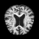 mri-dataset Object Detection Dataset by MRI Object Detection