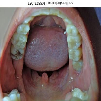 Tooth Detection Object Detection Dataset by Dental