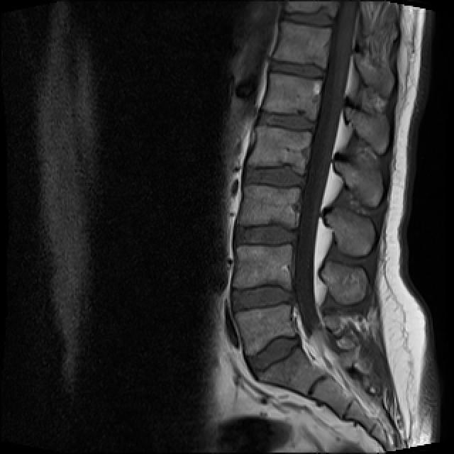 Lumbar-spine Semantic Segmentation Dataset by RP