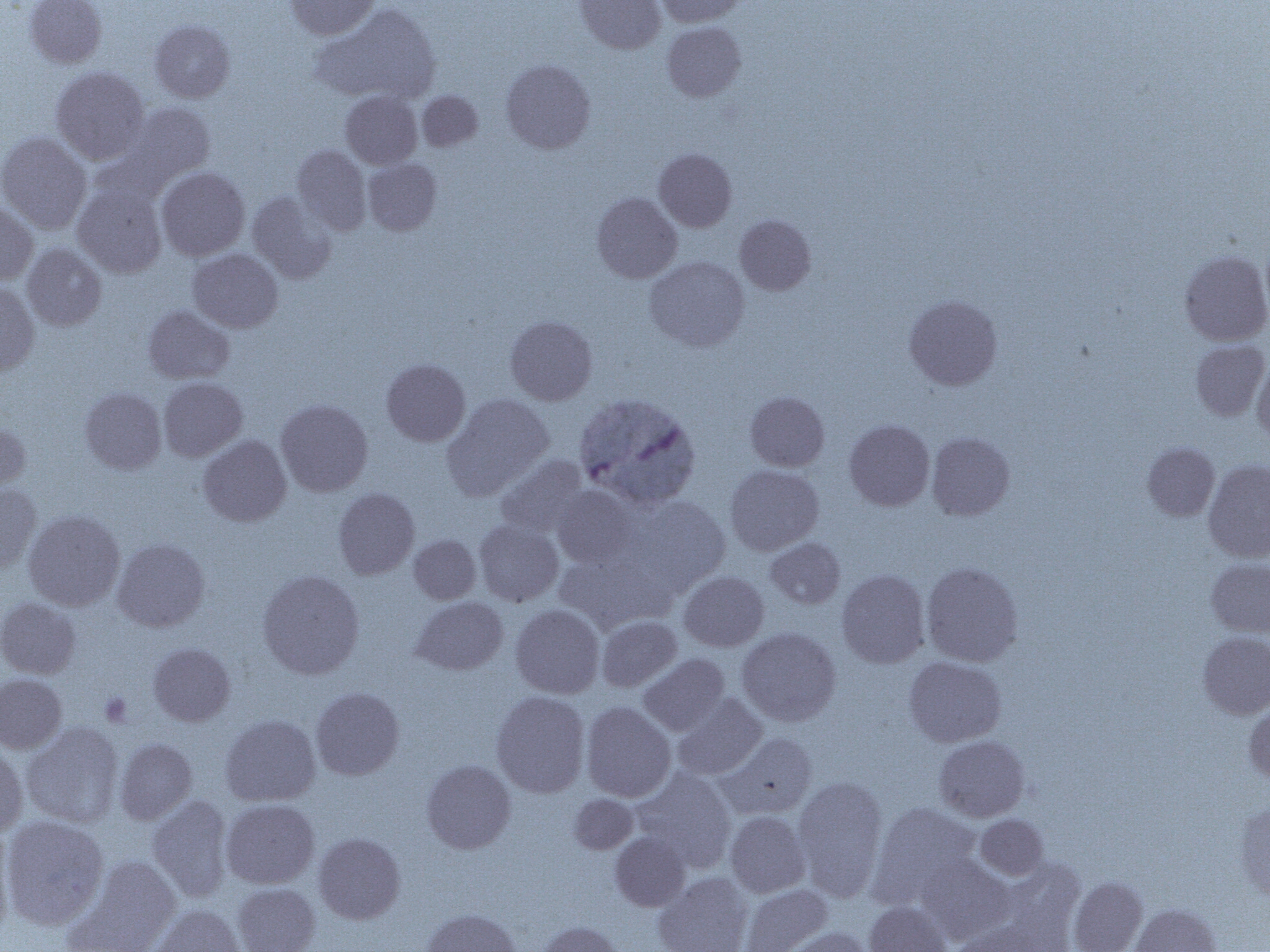 Manually Collected Dataset Object Detection Dataset By Stage2025