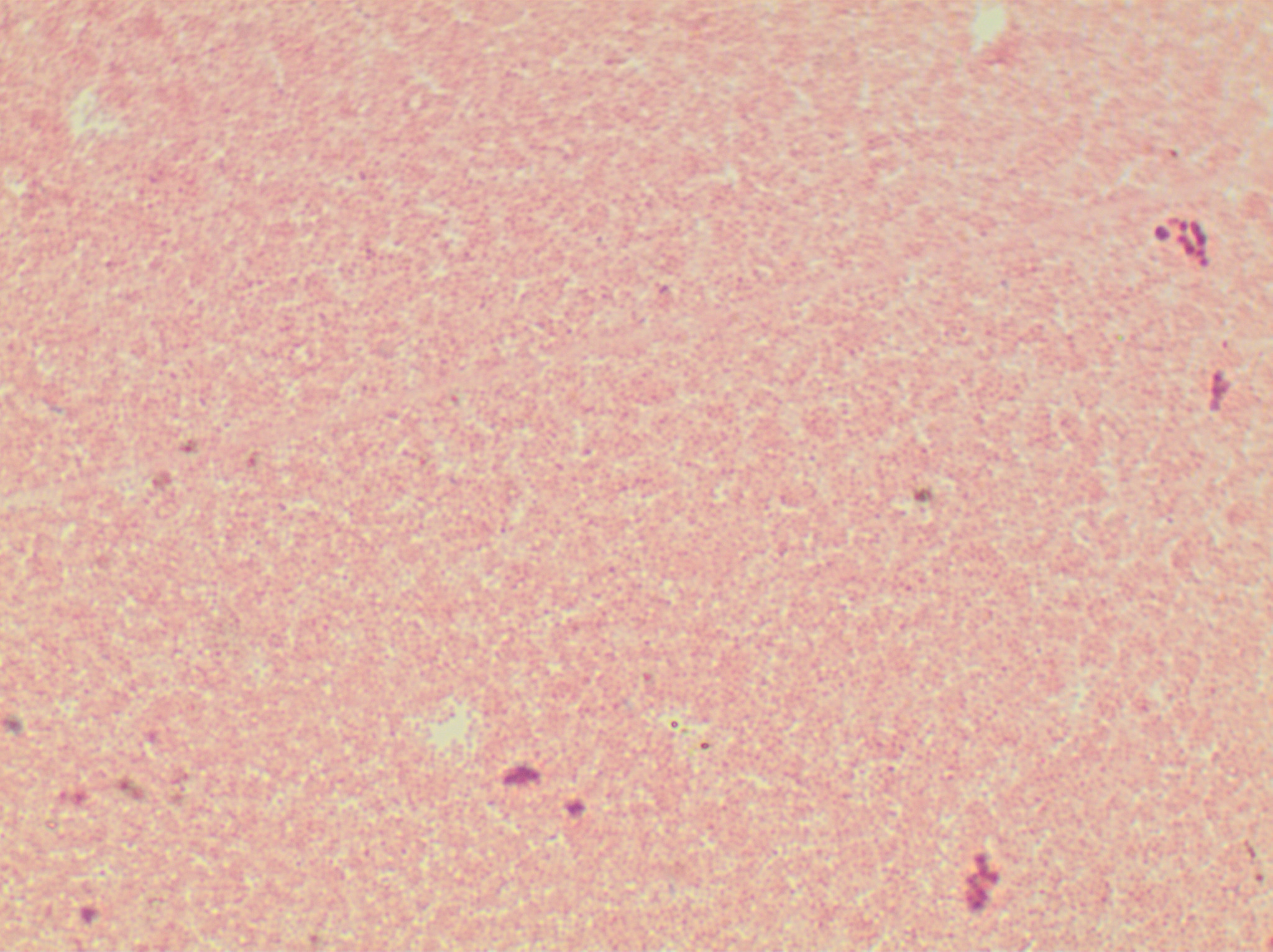 Bacteria Classifier Classification Model by Bacteria