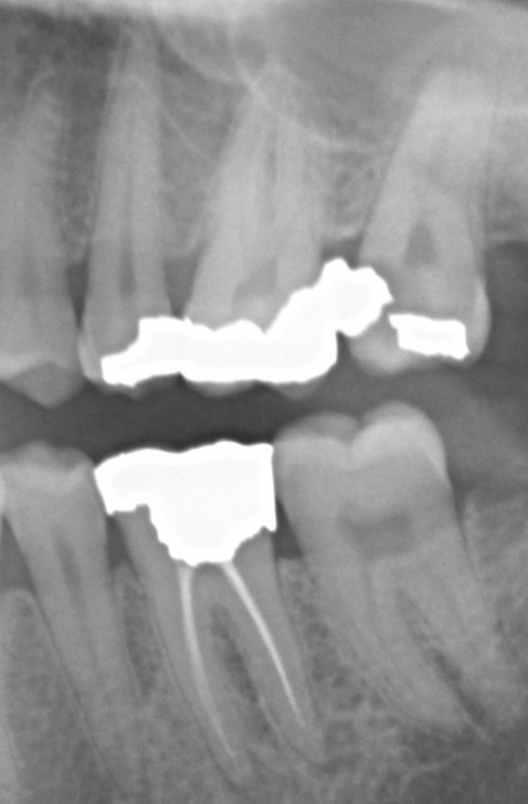 tamamı Instance Segmentation Dataset by University