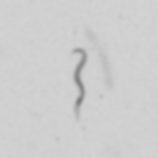 worm_population_blurred_3 Semantic Segmentation Dataset by ZimmerLab