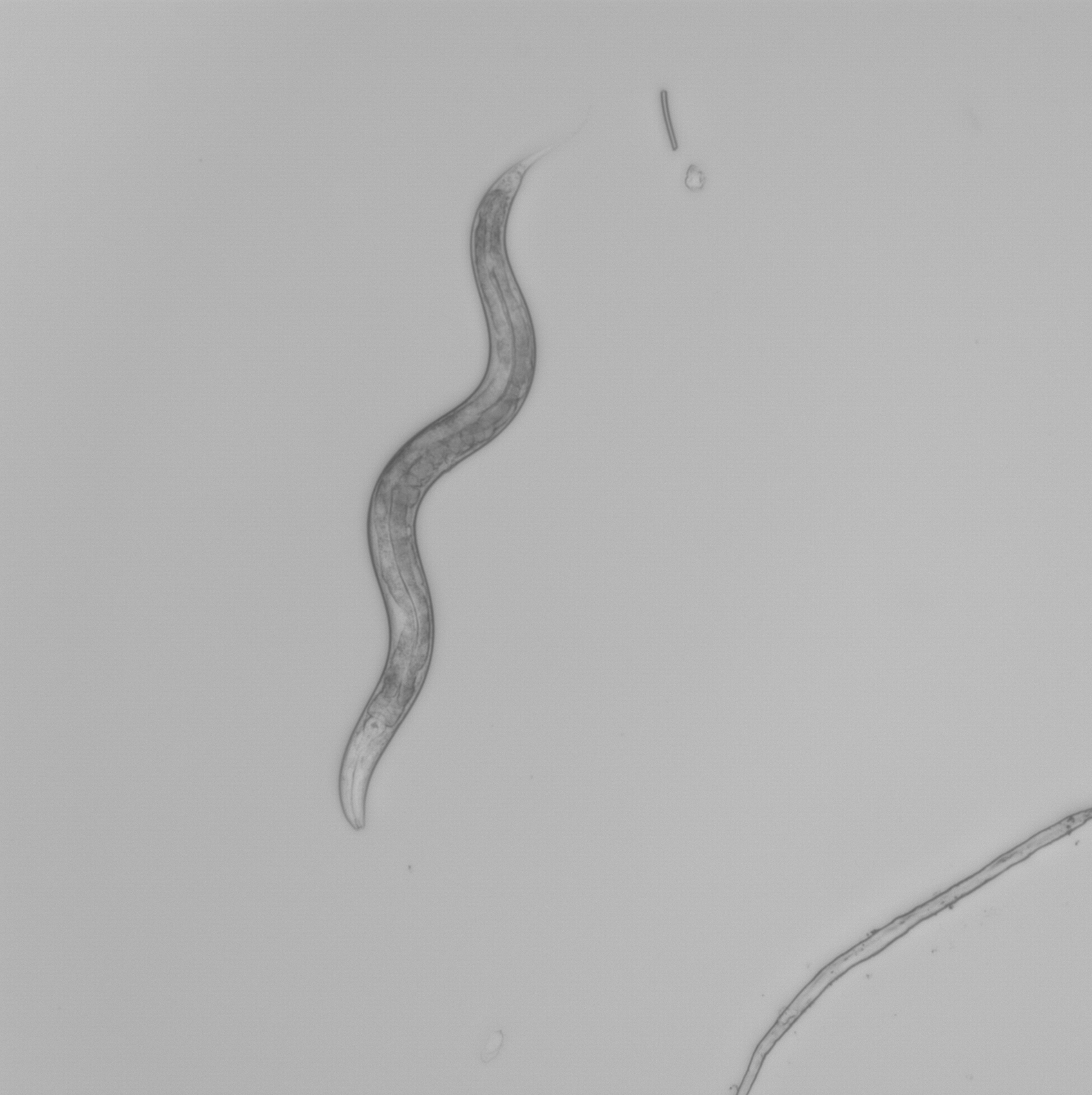 segment_worms_autoscope_1 Semantic Segmentation Dataset by ZimmerLab