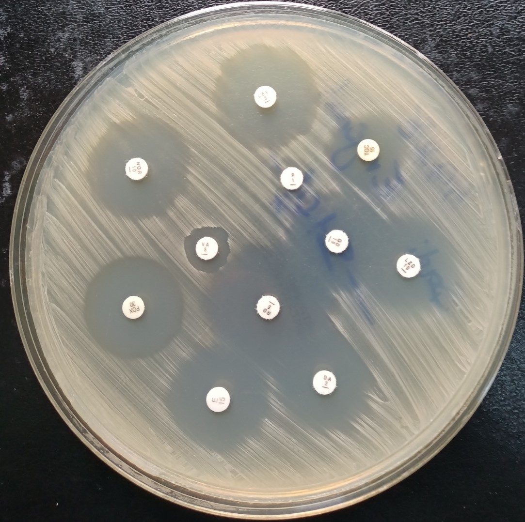 disk_bulucu Object Detection Model by antibiogram