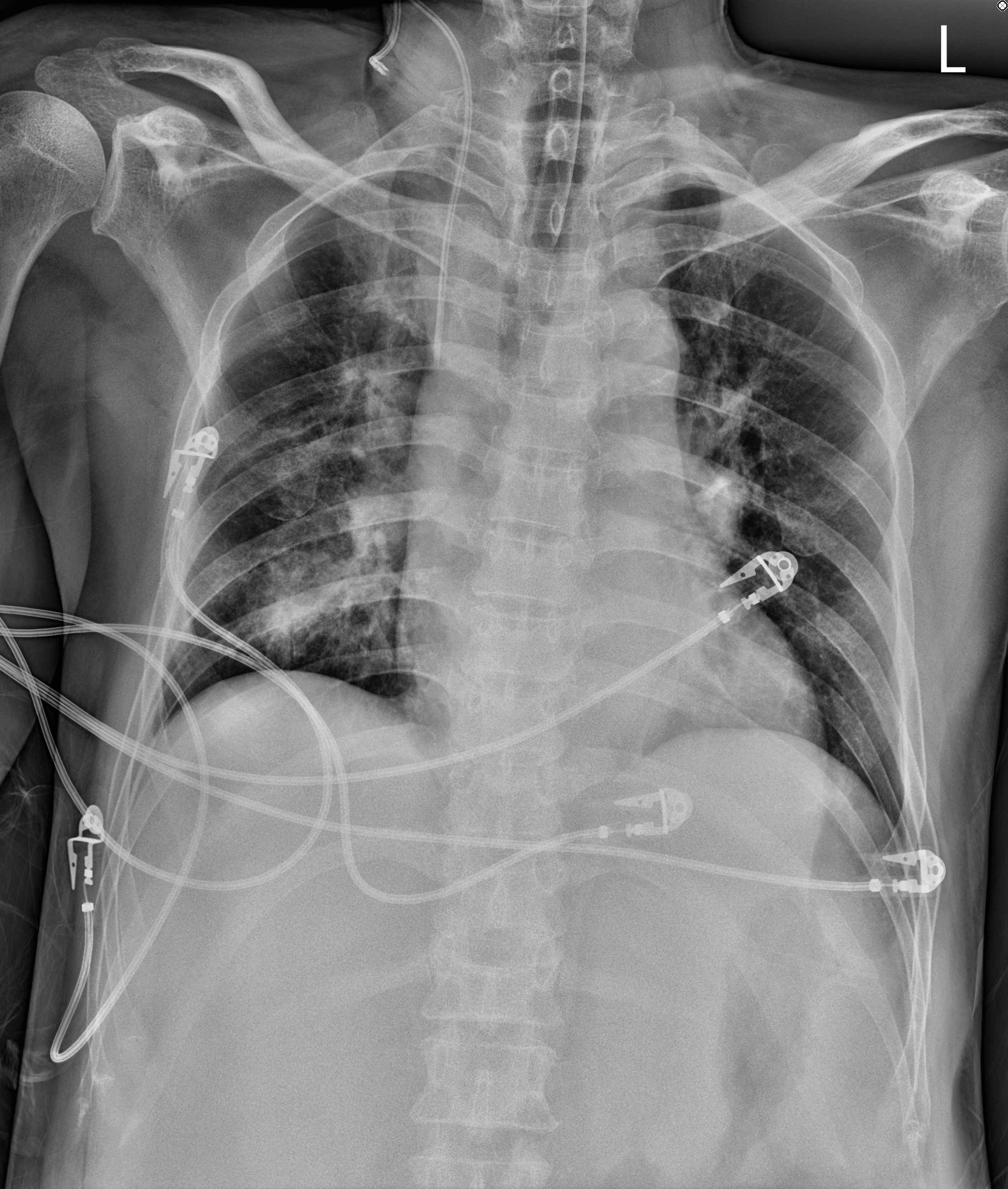 medical Instance Segmentation Dataset and Pre-Trained Model by yolo