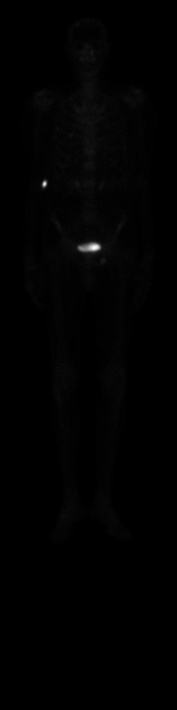 NucMed WBBS Object Detection Dataset by NucMed WBBS