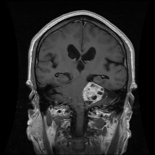 Image Net - Roboflow Universe