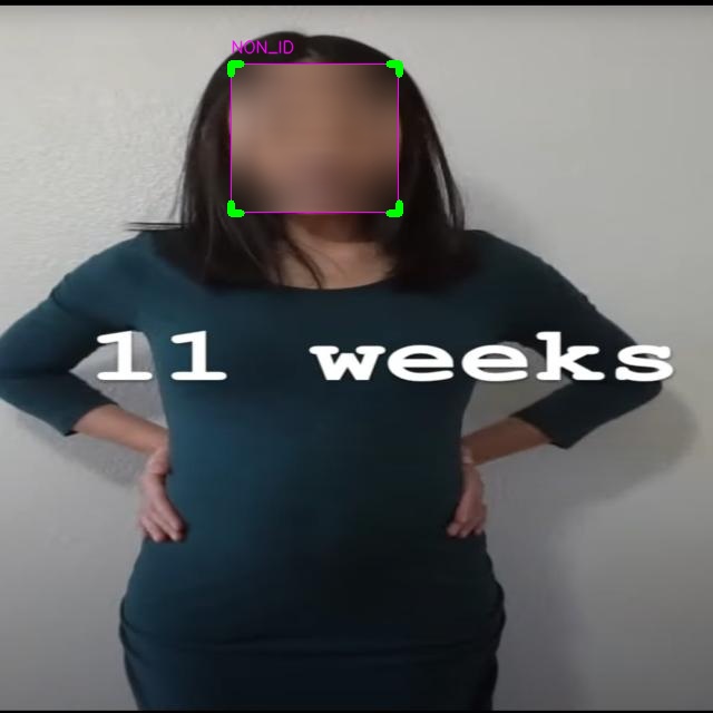 nonid_preg_weeks_cv Instance Segmentation Dataset by cv project