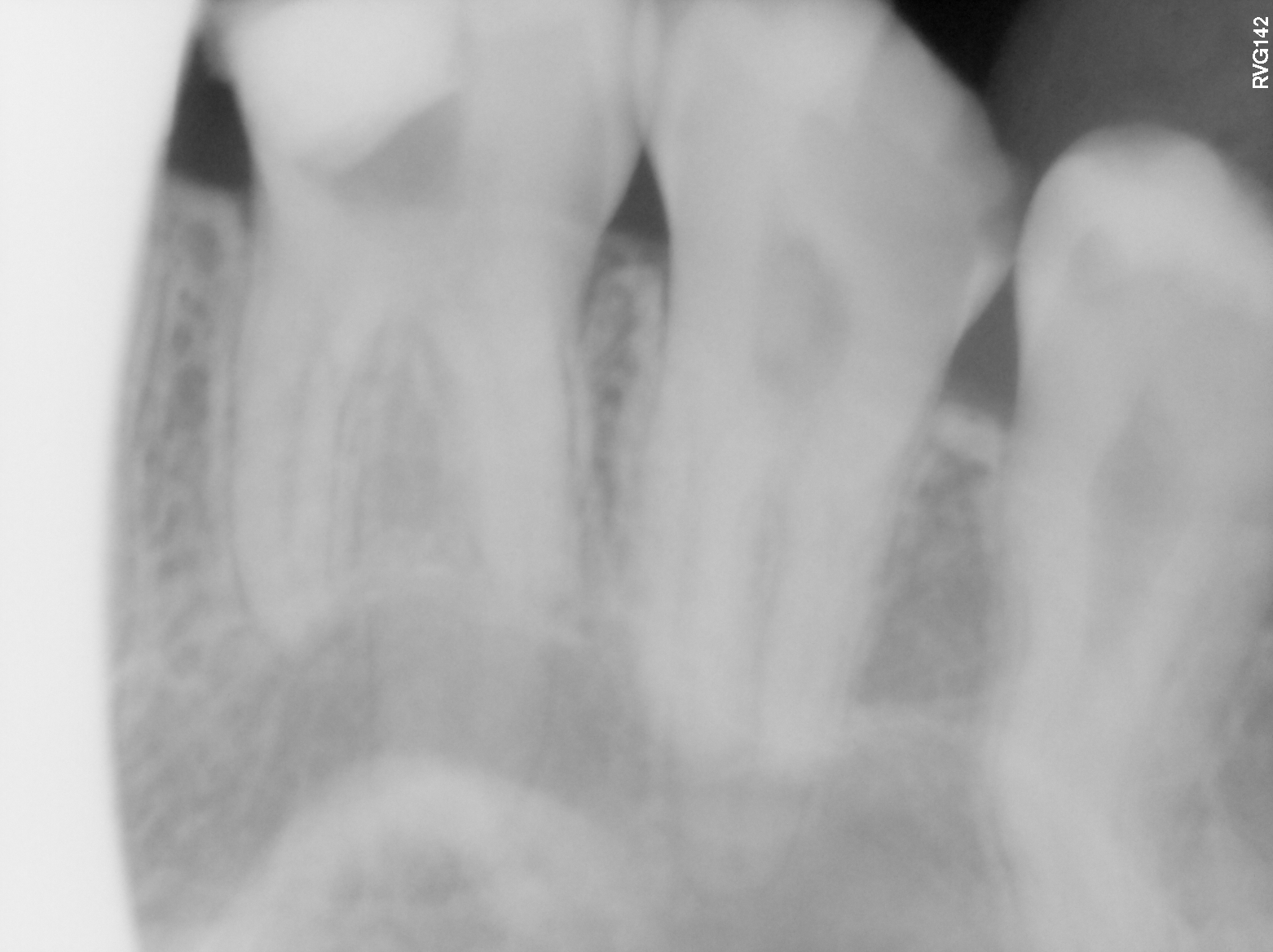apex-labeling Object Detection Dataset by apexlabeling
