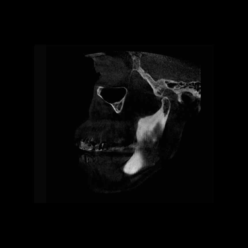 How to Use the TMJ Instance Segmentation API