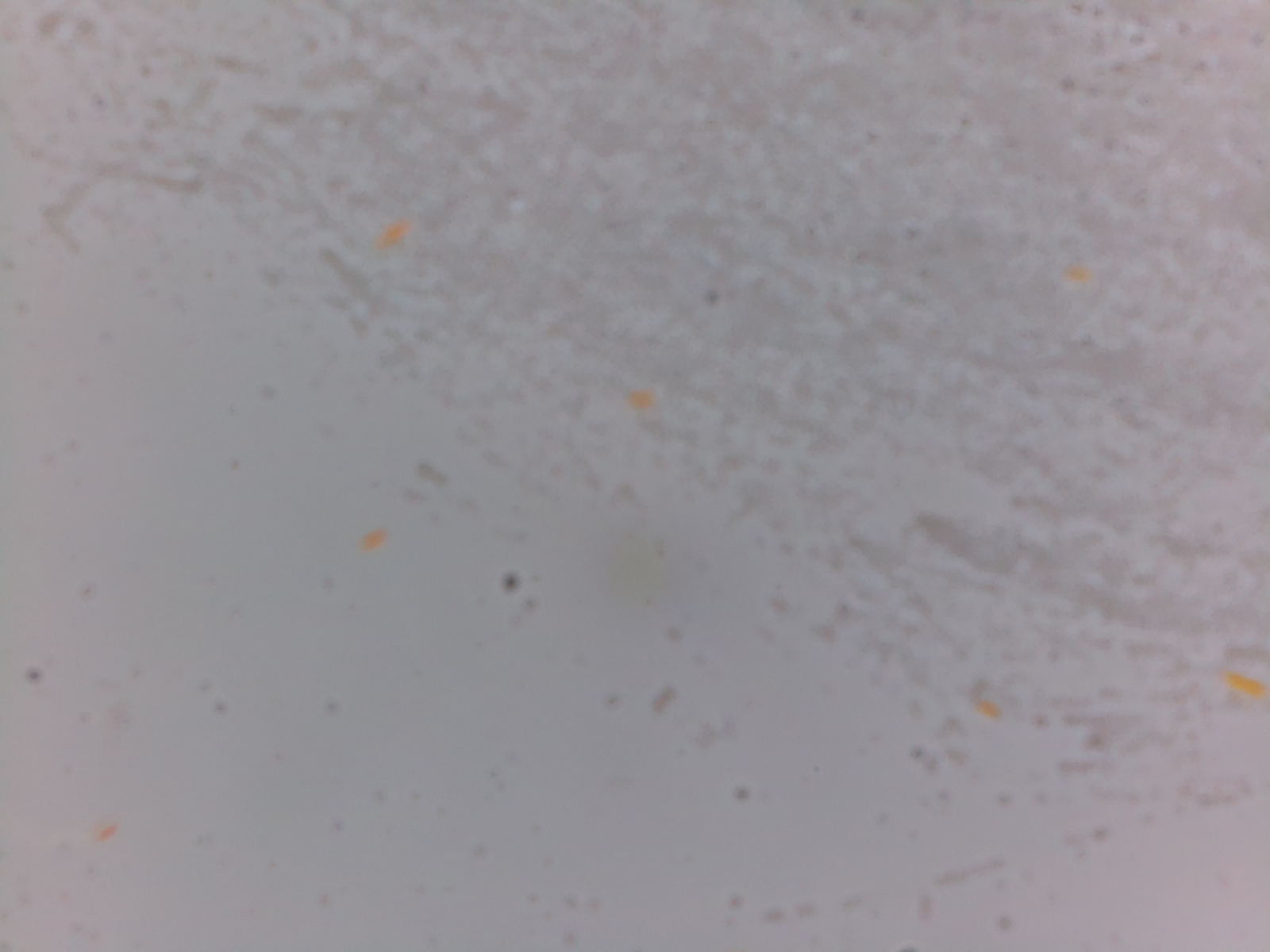 Yellow Rust Rpi Object Detection Dataset By Aspergillus