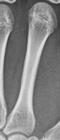 HF (hf-w1rwi) - Roboflow Universe