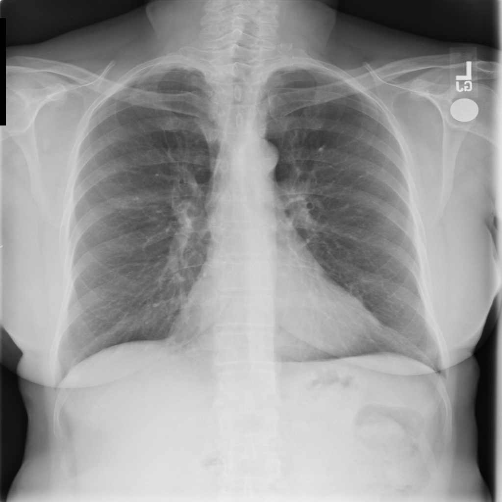 apical_original Instance Segmentation Dataset by innovation lab