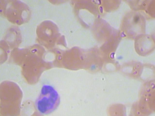 Bccd Autoencoder Embeddings Object Detection Dataset And Pre Trained Model By Workspaceone