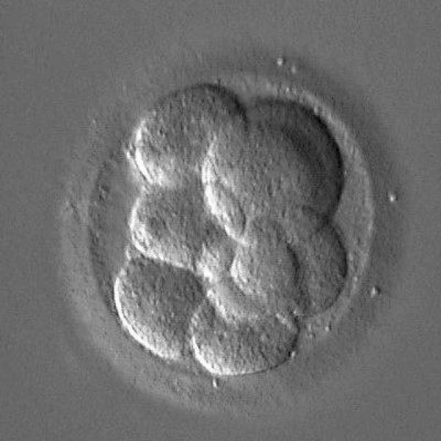 oocyte prediction Classification Dataset by Naveen