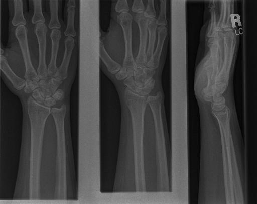 Bone Fracture Detection Object Detection Dataset by Traffic Management