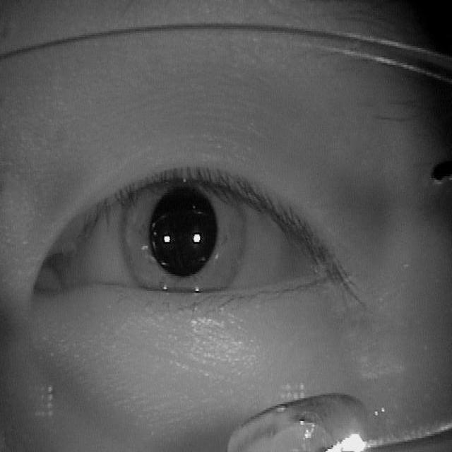 Iris Detection Object Detection Dataset By Kary