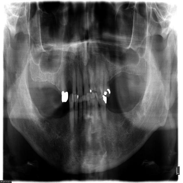 Max/mand Object Detection Dataset by Renan
