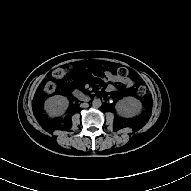 medical Object Detection Dataset by JoJang