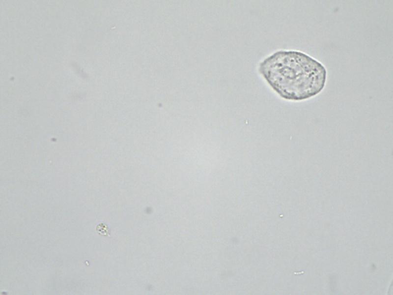 Urine Cells Object Detection Dataset And Pre Trained Model By Aperol Colab