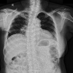 x-ray Object Detection Dataset by test