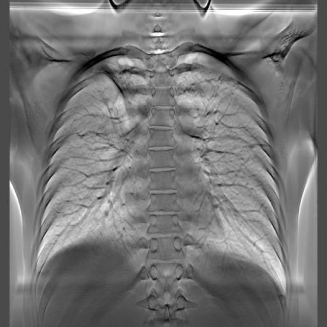 Disease Detection Sl Classification Dataset And Pre Trained Model By Capstone