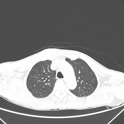 normal Object Detection Dataset and Pre-Trained Model by CTScan