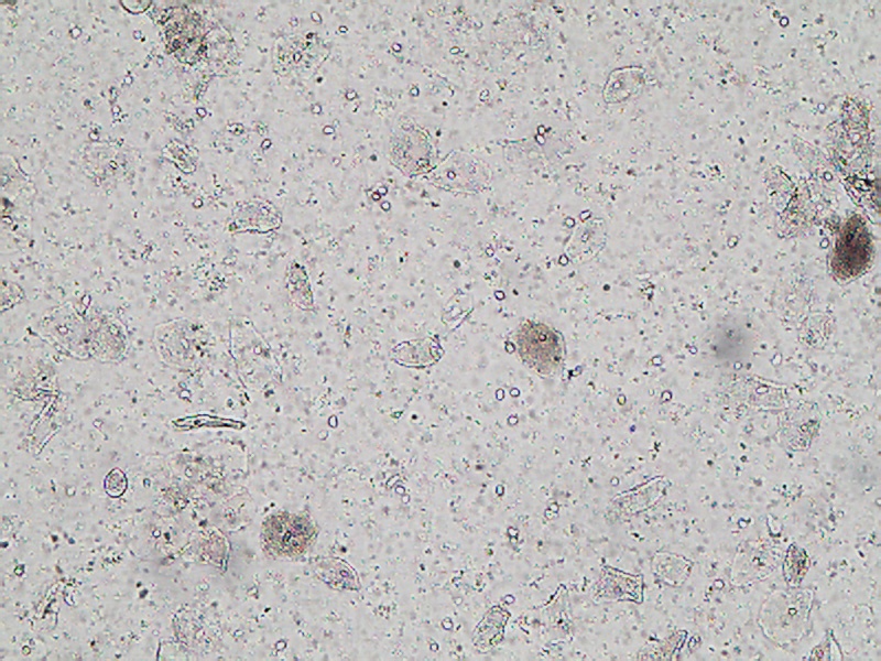 Urine Sediment Detection Object Detection Dataset By Object Detection