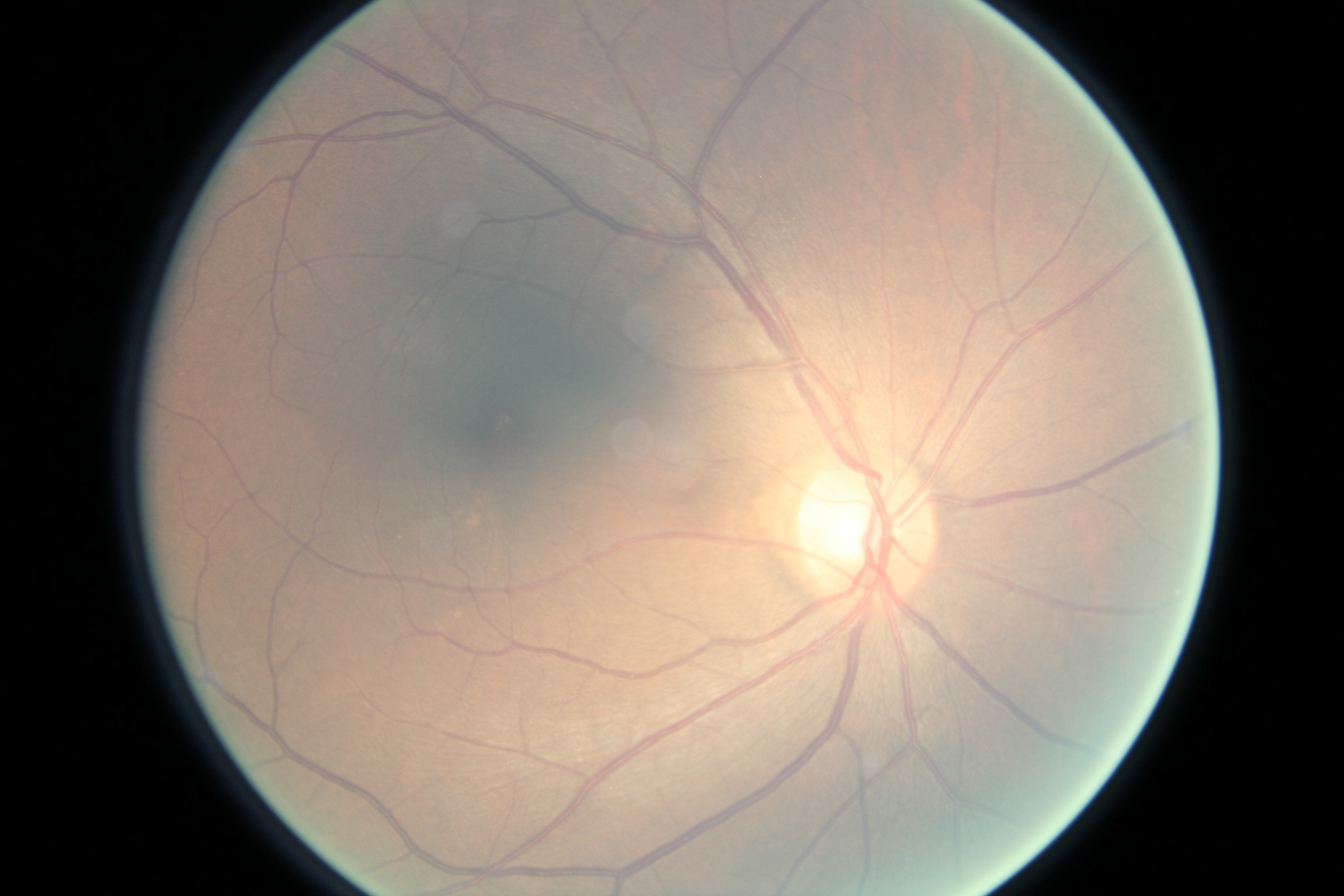 Optik Disk Detection Object Detection Dataset And Pre Trained Model By Optikdisk