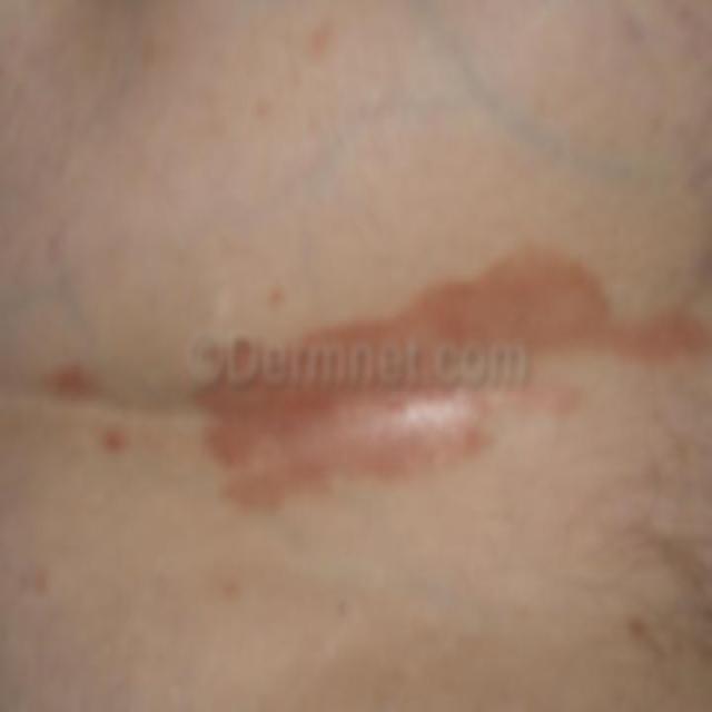 Tugas Akhir (tugas-akhir-fktkx) - Roboflow Universe