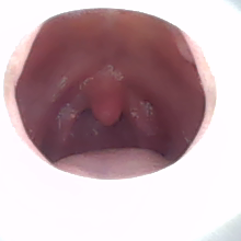 mouth Object Detection Dataset by Sijie Tao