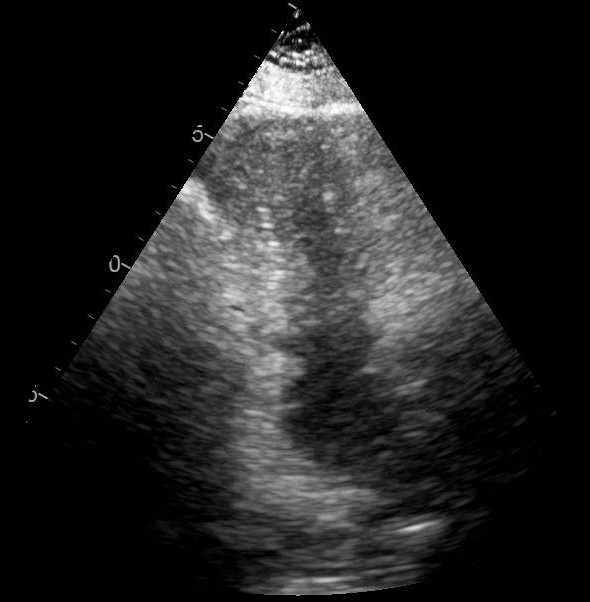 Echo chamber detection Object Detection Dataset by echo