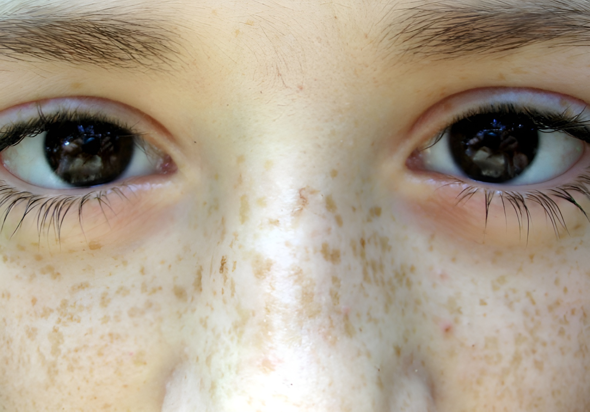 skin disease detection Object Detection Dataset by van loc