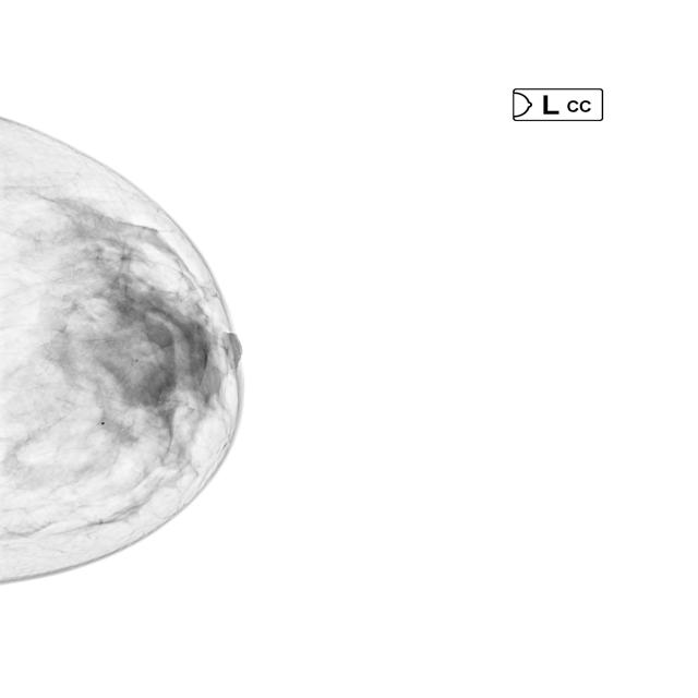 Kalsifikasyon Tespiti Object Detection Dataset And Pre Trained Model By Trialsaitolia
