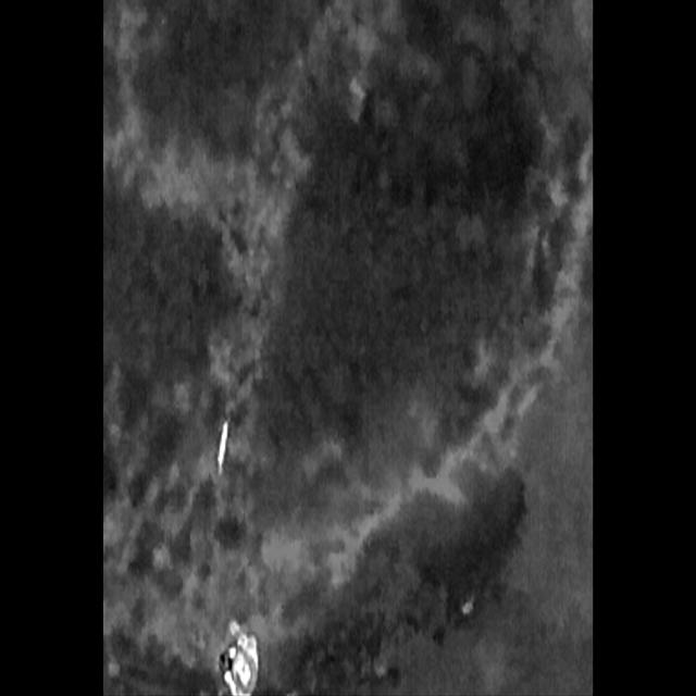 Ferret Instance Segmentation Dataset and Pre-Trained Model by Uni